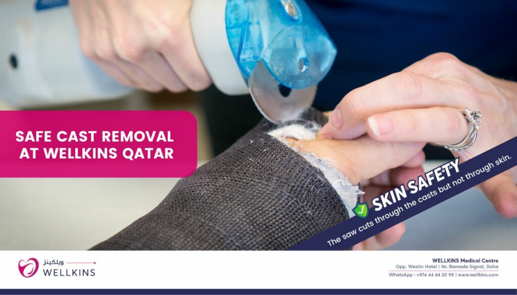 Cast Removal | Dr.Reneesh - Orthopedic Surgeon in Qatar