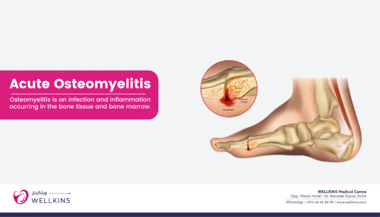 Explore localized swelling, mass, and lump concerns | Dr.Reneesh ...