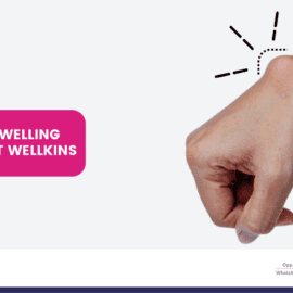 Explore localized swelling, mass, and lump concerns | Dr.Reneesh ...