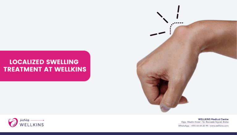 Explore localized swelling, mass, and lump concerns | Dr.Reneesh ...